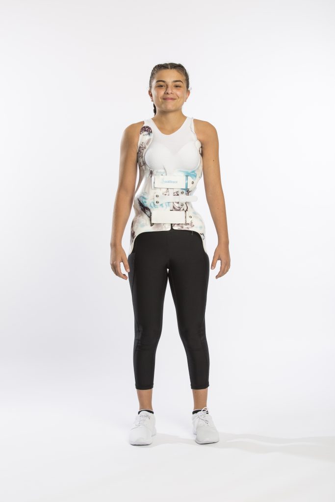 Transform Your Life with a Scoliosis Brace in Toronto: 5 Empowering ...